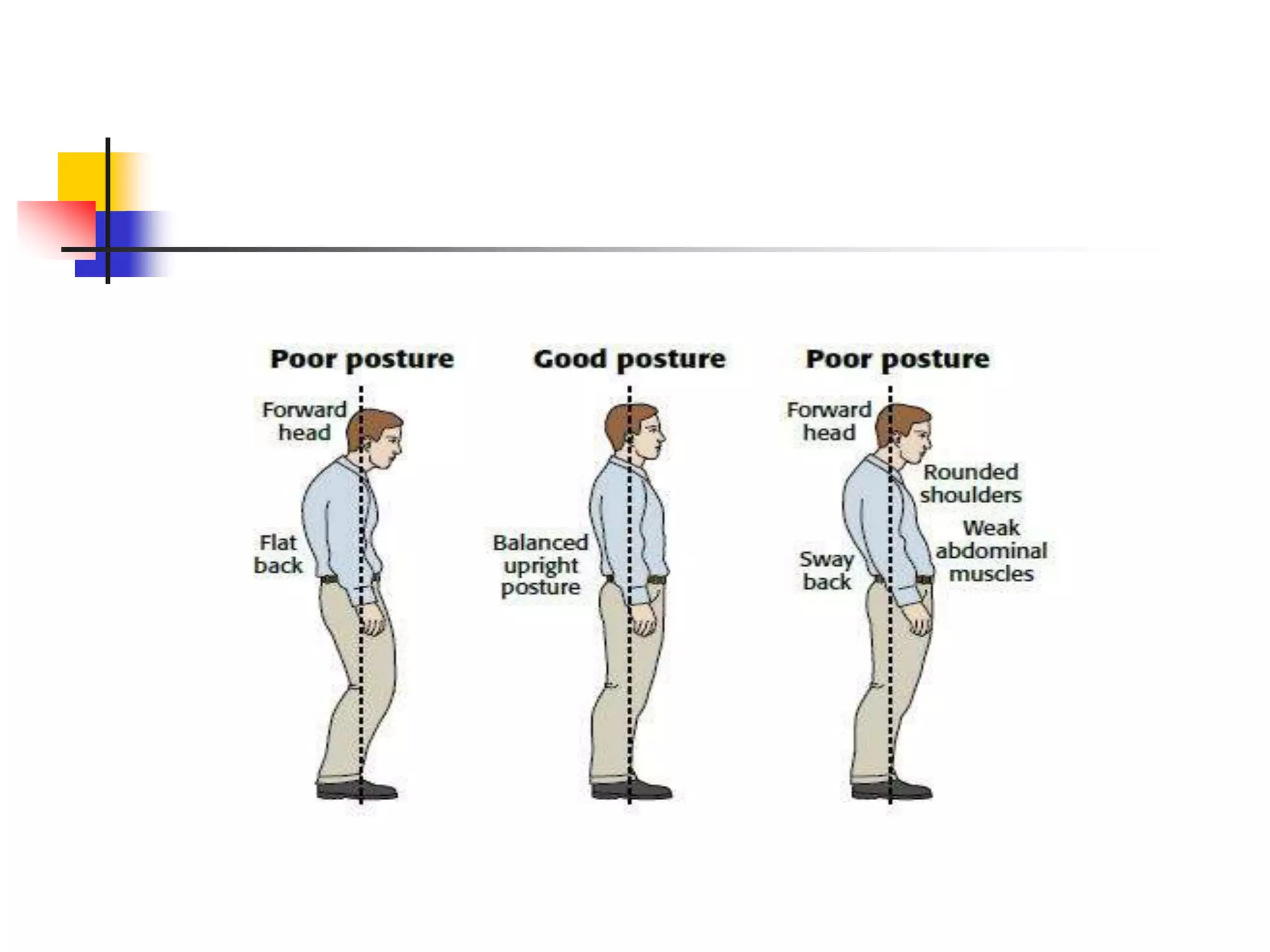 Bad posture | PPT