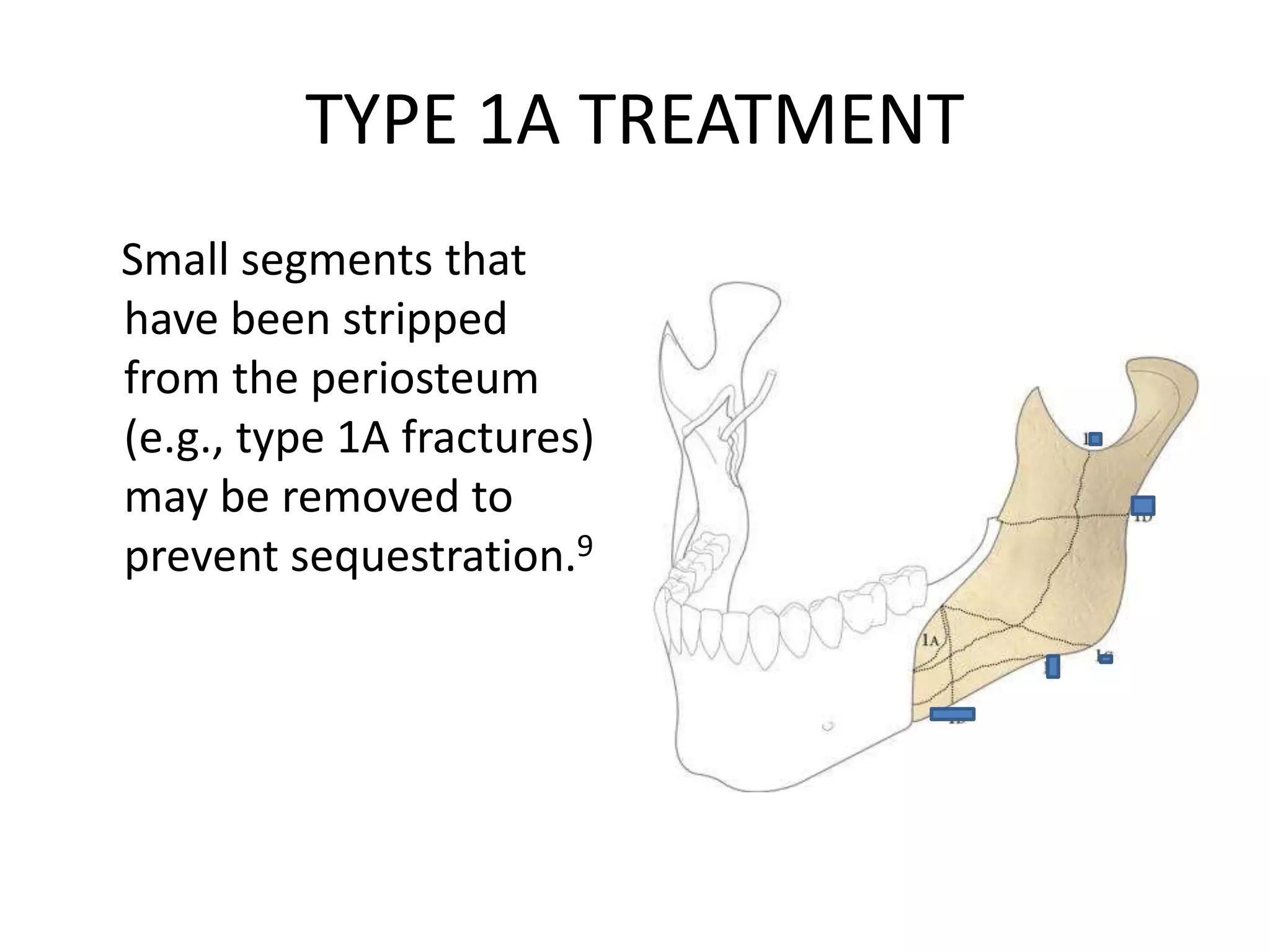 Bad splits in bsso | PPTX