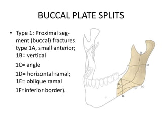 Bad splits in bsso | PPTX