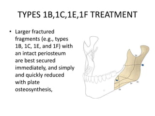 Bad splits in bsso | PPTX