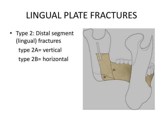 Bad splits in bsso | PPTX | Bone and Joint Conditions | Diseases and ...