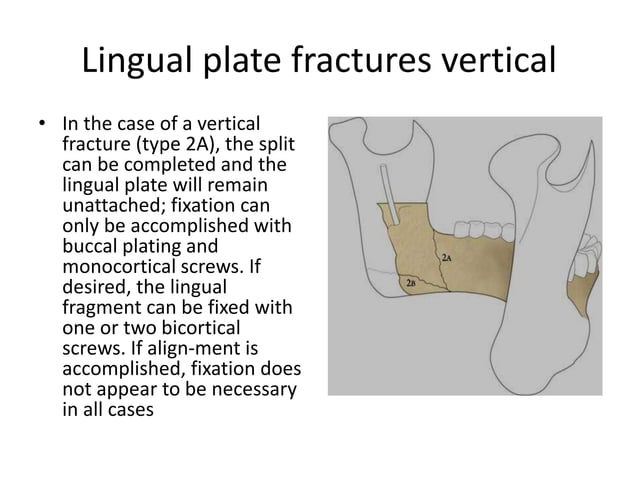 Bad splits in bsso | PPTX | Bone and Joint Conditions | Diseases and ...