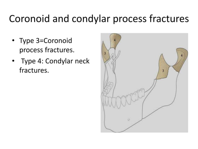 Bad splits in bsso | PPTX | Bone and Joint Conditions | Diseases and ...