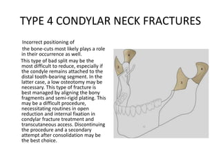 Bad splits in bsso | PPTX