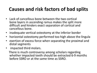 Bad splits in bsso | PPTX