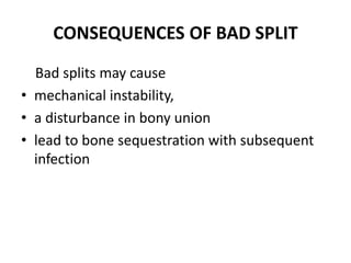 Bad splits in bsso | PPTX