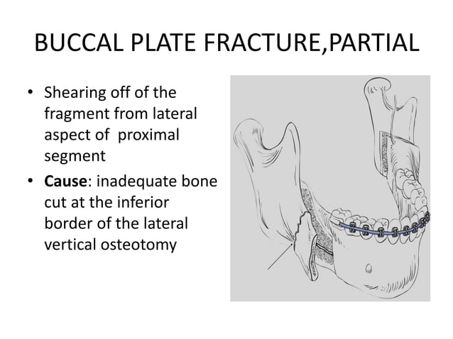 Bad splits in bsso | PPTX | Bone and Joint Conditions | Diseases and ...