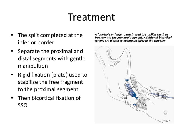 Bad splits in bsso | PPTX | Bone and Joint Conditions | Diseases and ...