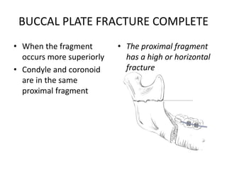 Bad splits in bsso | PPTX