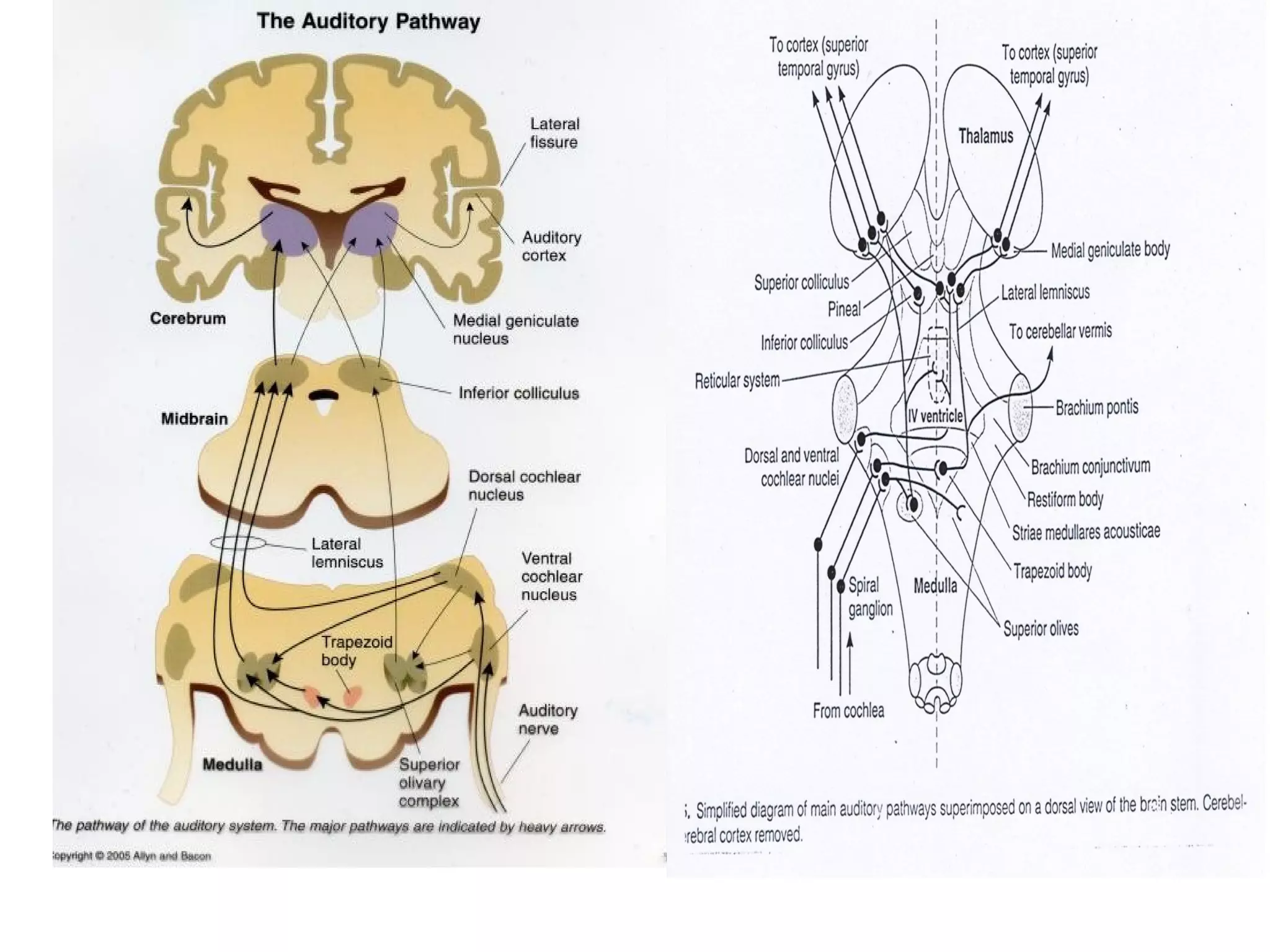 BAEP, BERA, BEP, Brainstem auditory evoked potential By Murtaza Syed | PPT