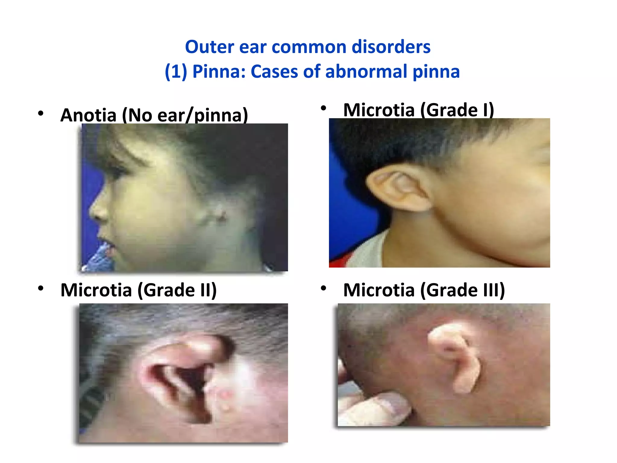 Anatomy of Ear and BERA with its technical aspects. by Murtaza. March ...