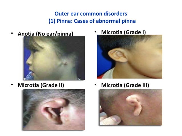 Anatomy of Ear and BERA with its technical aspects. by Murtaza. March ...