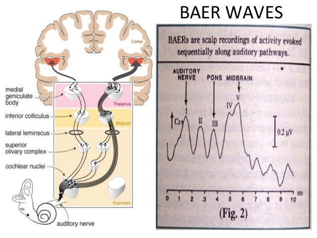 Anatomy of Ear and BERA with its technical aspects. by Murtaza. Marc…