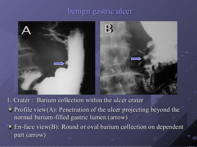 Ba examination of gi tract