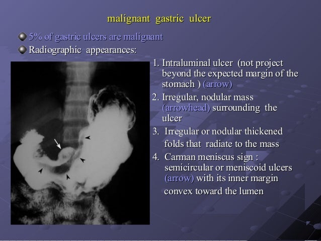 Ba examination of gi tract