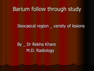 Ba follow through study for ileocecal region | PPT