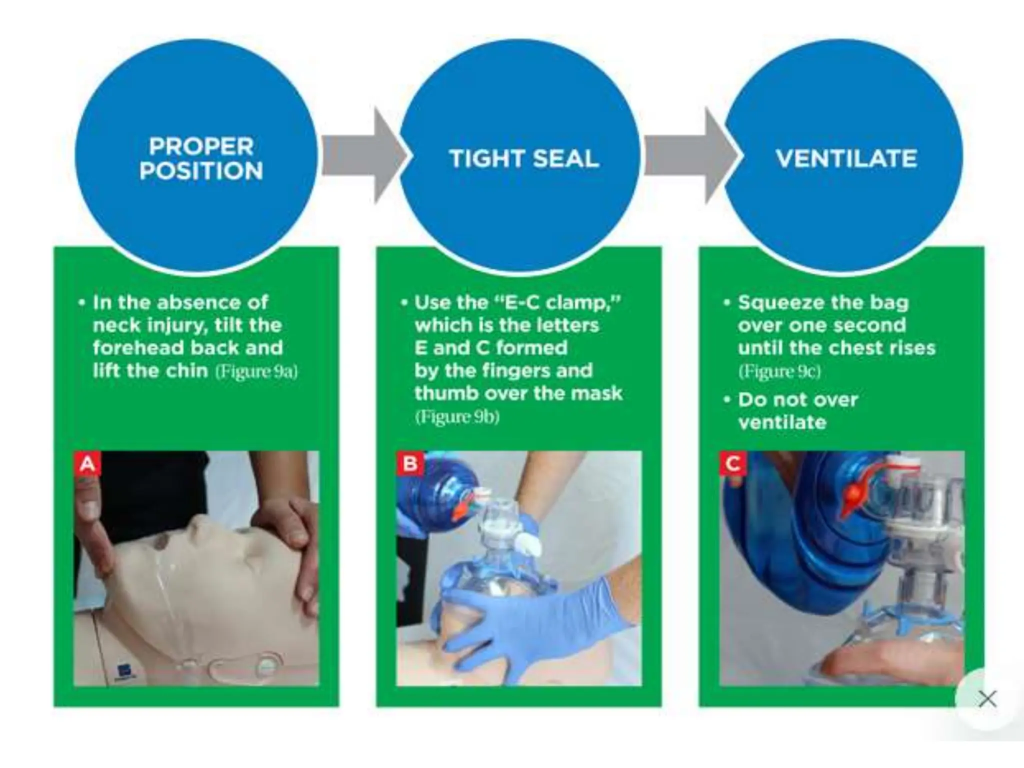 Bag and mask.pptx Pediatric Bag and mask.pptx Pediatric | PPT