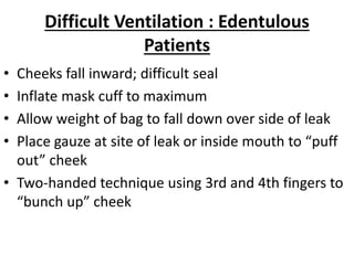 Bag and mask.pptx Pediatric Bag and mask.pptx Pediatric | PPT