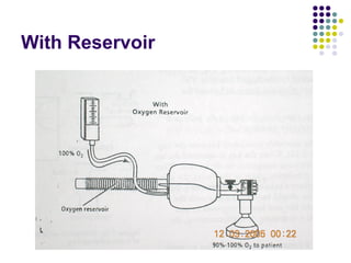 Bag & mask equipment | PPT