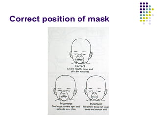 Bag & mask equipment | PPT