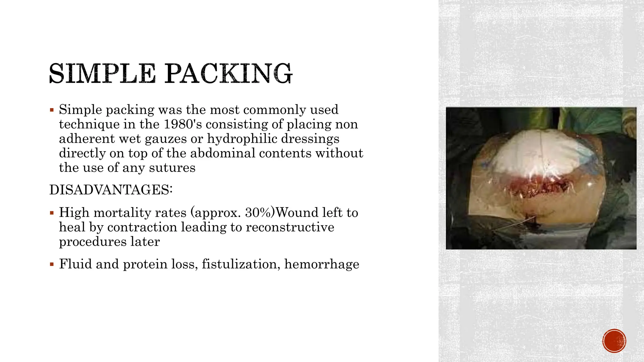 VARIOUS Temporary CLOSURE TECHNIQUES IN OPEN ABDOMEN.pptx
