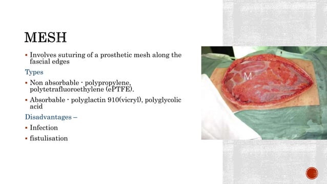 VARIOUS Temporary CLOSURE TECHNIQUES IN OPEN ABDOMEN.pptx