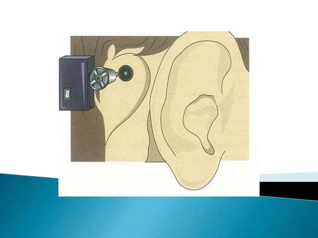 Baha & active middle ear implants | PPTX