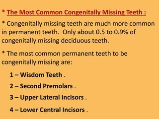 Congenitally missing & supernumerary teeth | PPTX