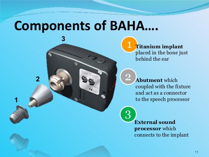 Bone Anchored Hearing Aid JC