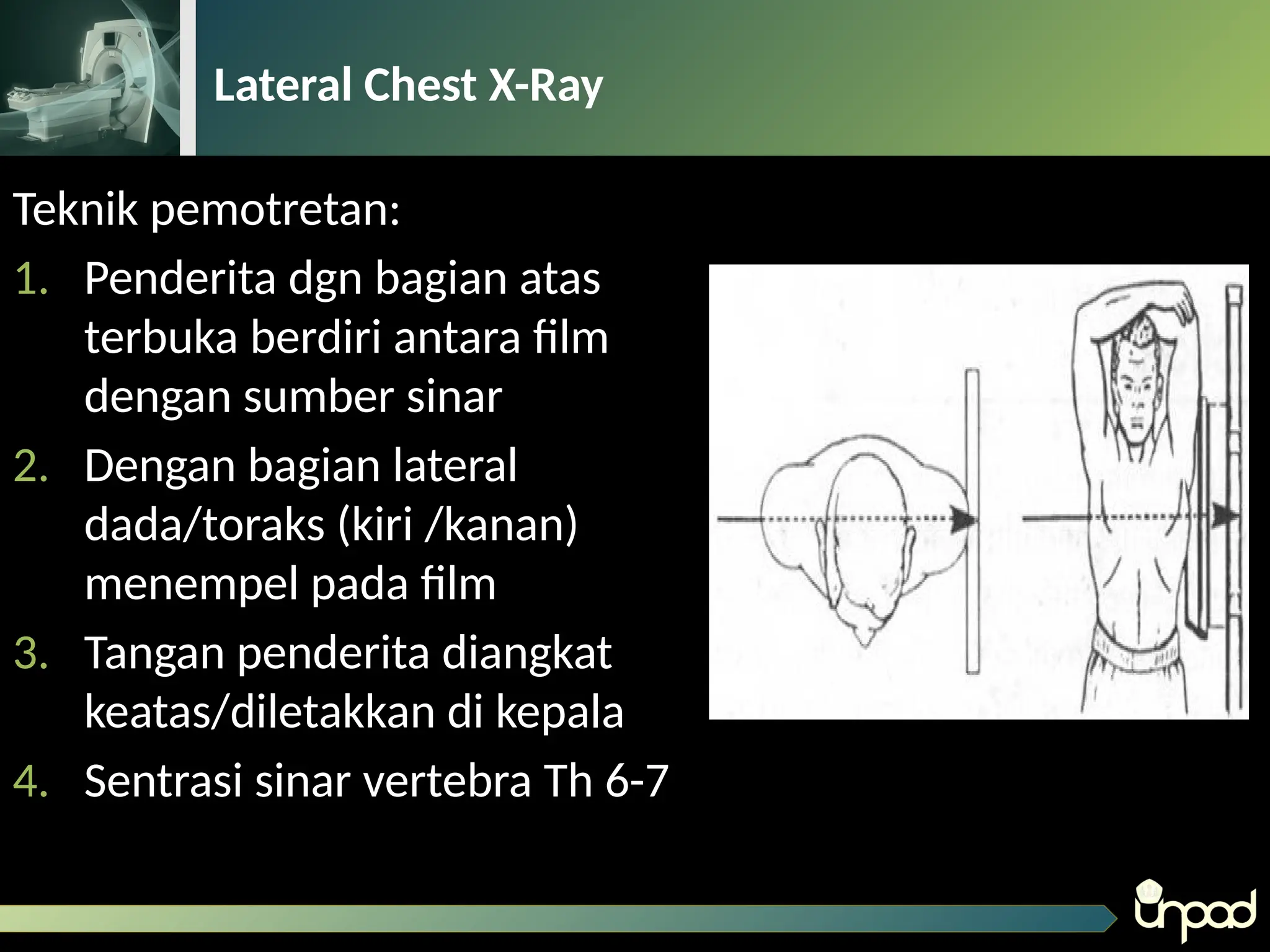 Bahan Thorax Normal untuk radiologi pptx | PPTX