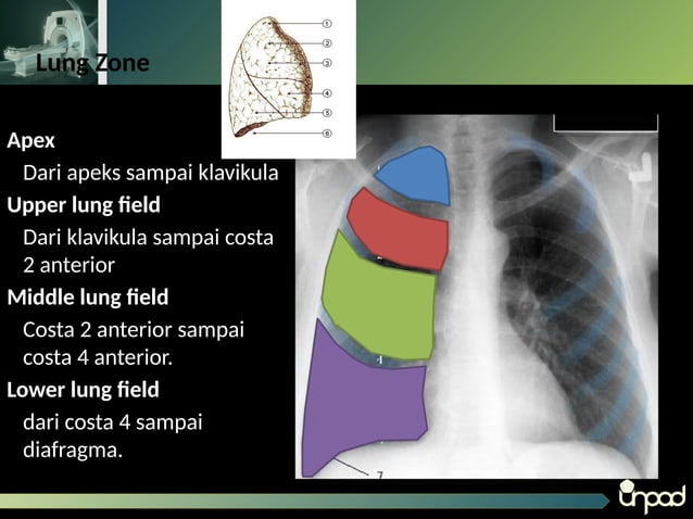 Bahan Thorax Normal untuk radiologi pptx | PPTX