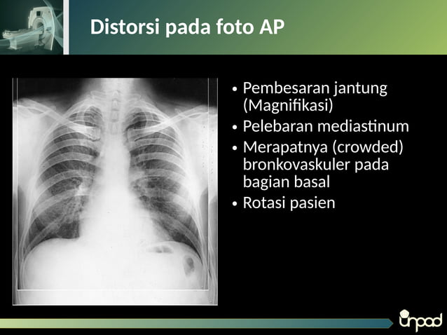 Bahan Thorax Normal untuk radiologi pptx | PPTX