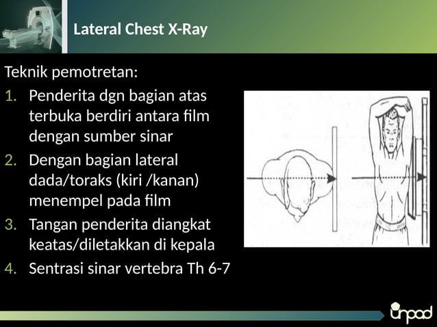 Bahan Thorax Normal untuk radiologi pptx | PPTX