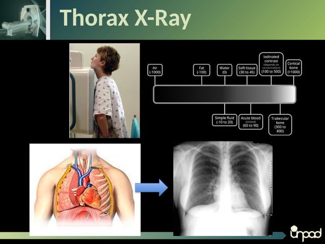 Bahan Thorax Normal untuk radiologi pptx | PPTX