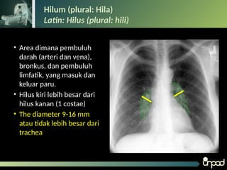 Bahan Thorax Normal untuk radiologi pptx | PPTX