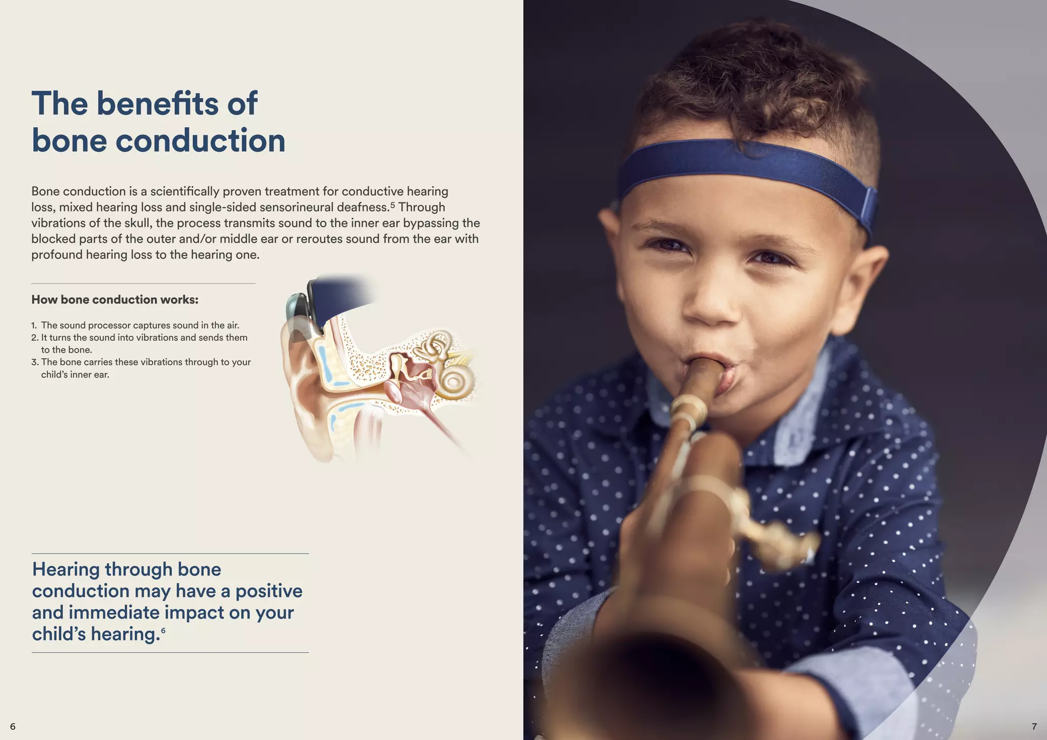 HEARING HABILITATION FOR CHILDREN WITH MICROTIA | PDF