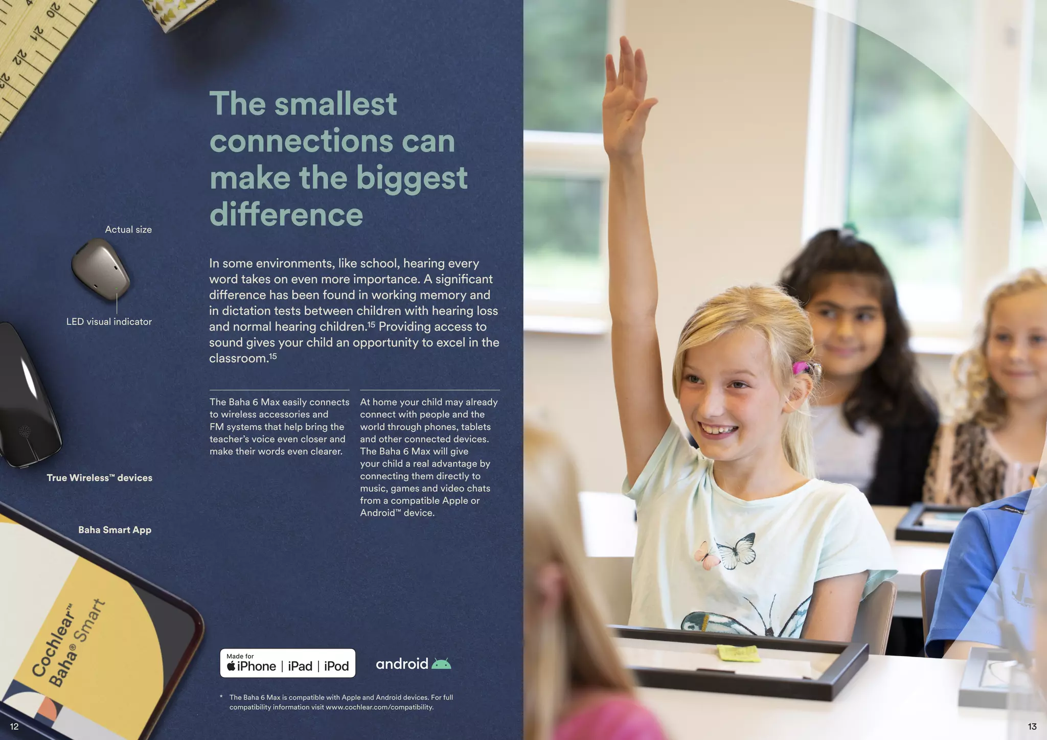 HEARING HABILITATION FOR CHILDREN WITH MICROTIA | PDF