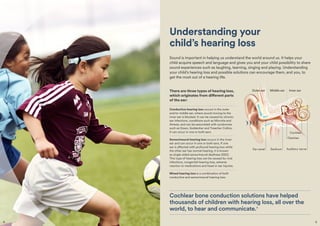 HEARING HABILITATION FOR CHILDREN WITH MICROTIA | PDF