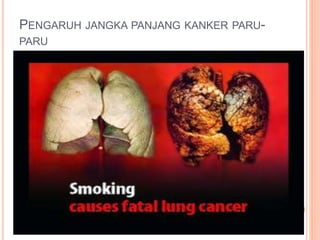 BAHAYA MEROKOK.pptx