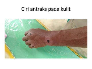 Bahaya Penyakit antraks bagi hewan peliharaaan | PPT