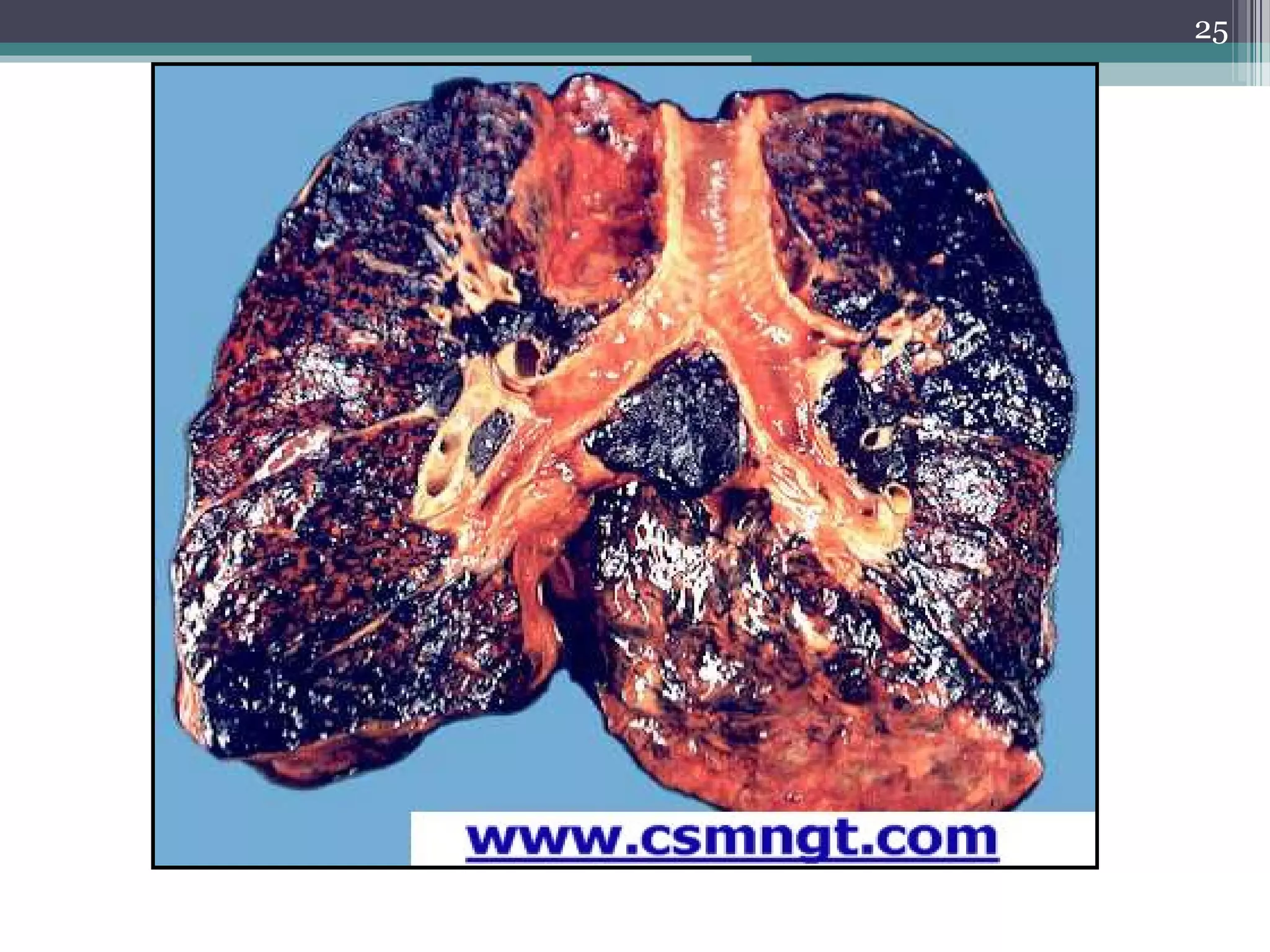 Bahaya Rokok Terhadap Kesehatan | PPT