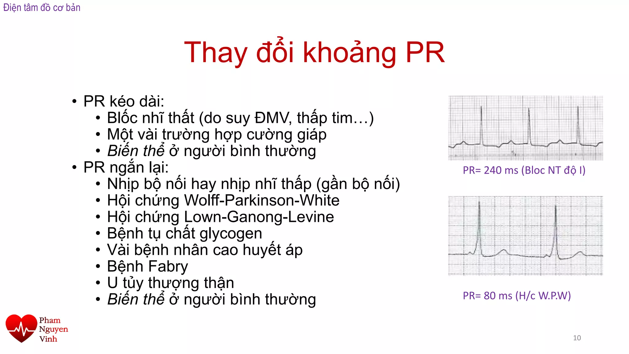 Bai 1-khai-niem-co-ban-ecg-pham-nguyen-vinh | PDF