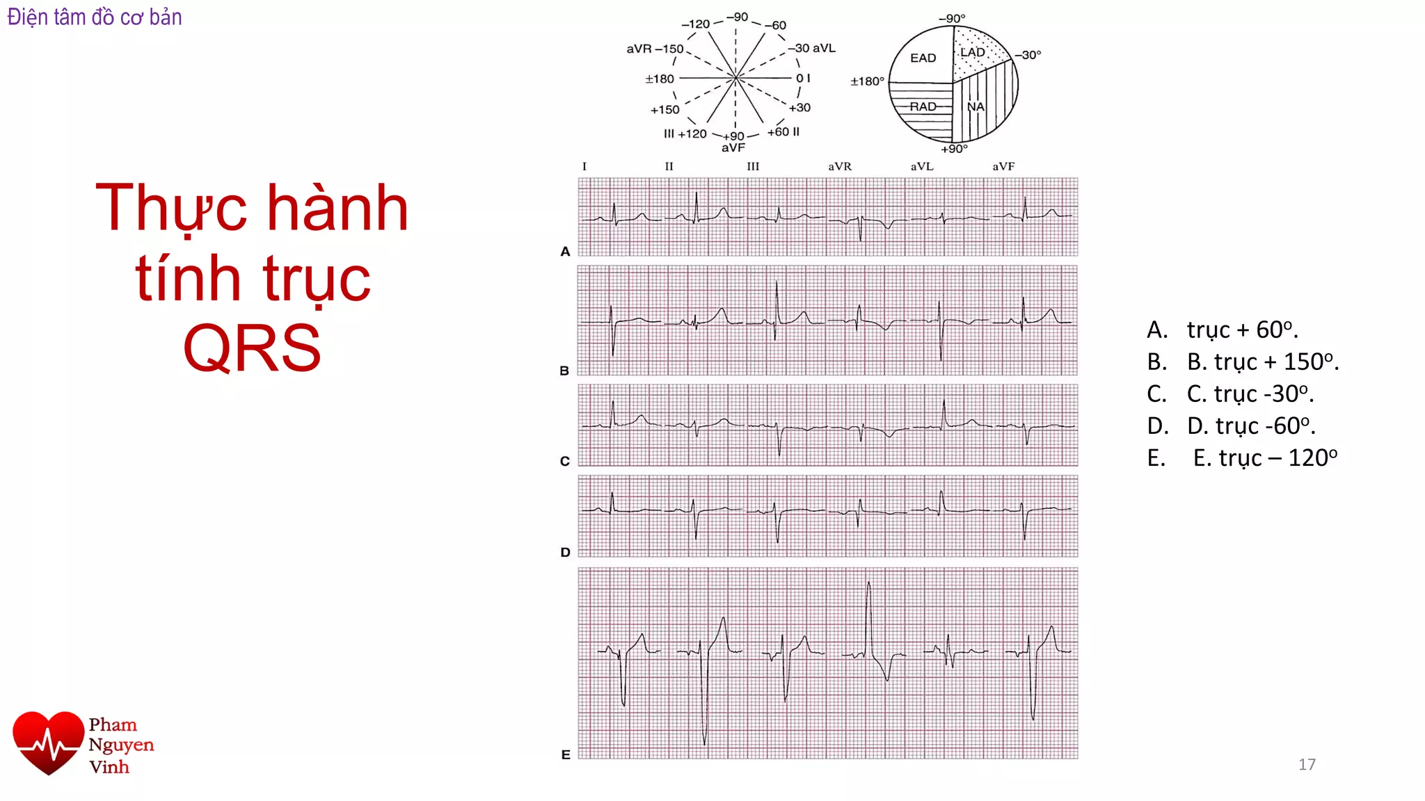 Bai 1-khai-niem-co-ban-ecg-pham-nguyen-vinh | PDF