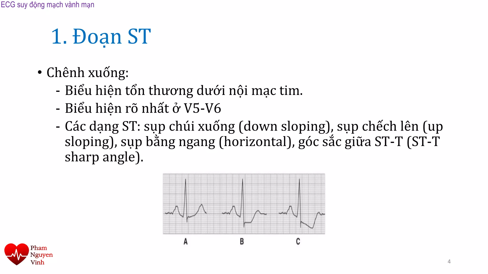 Bai 4-suy-dong-mach-vanh-man-pham-nguyen-vinh | PPT