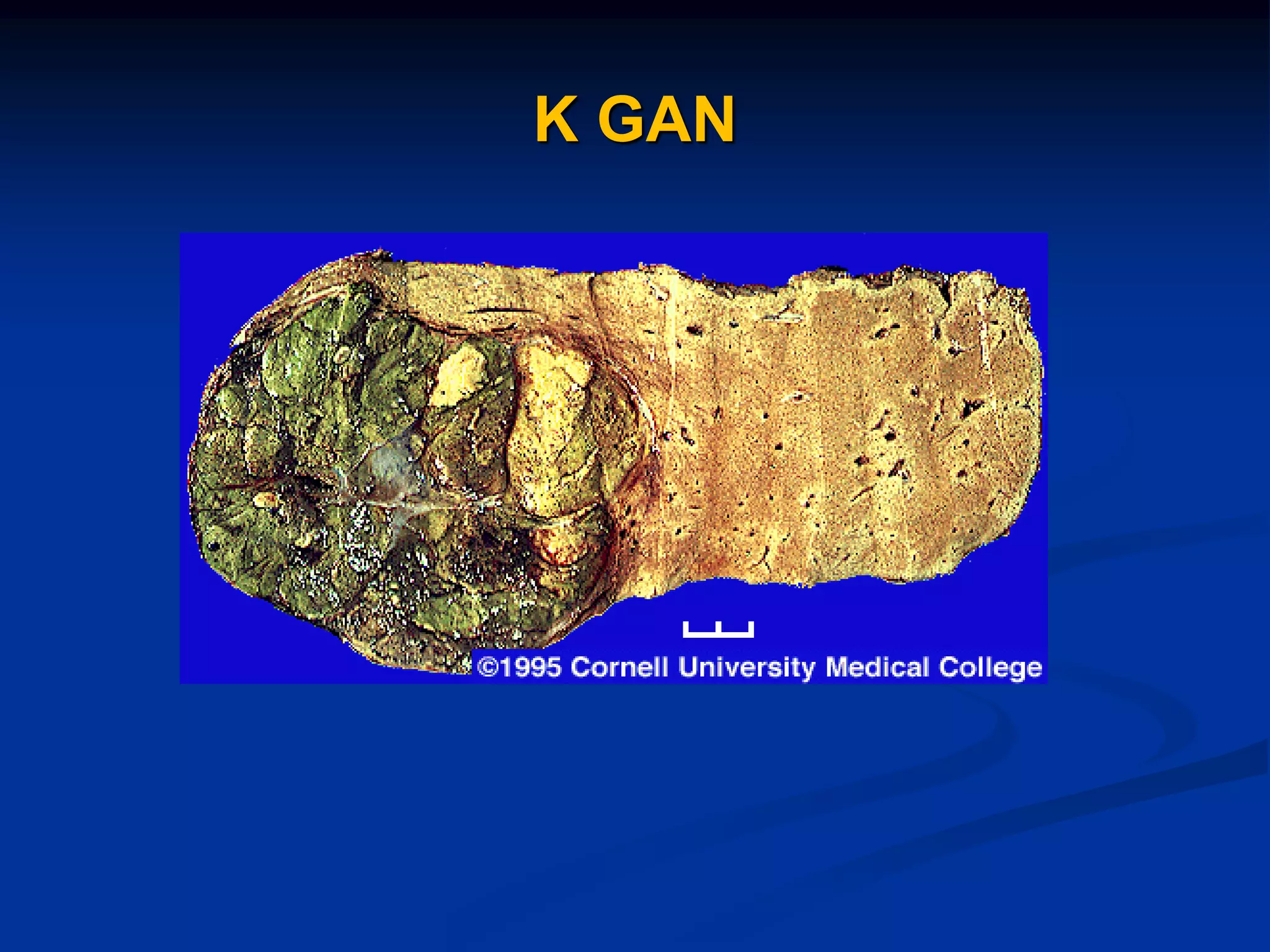 bai-giang-benh-ly-xo-gan.pdf