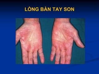 bai-giang-benh-ly-xo-gan.pdf