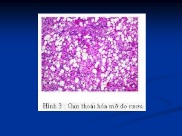 bai-giang-benh-ly-xo-gan.pdf