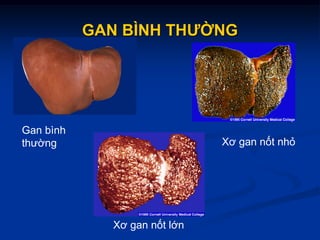 bai-giang-benh-ly-xo-gan.pdf