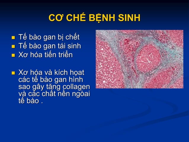 bai-giang-benh-ly-xo-gan.pdf