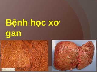 bai-giang benh-hoc-xo-gan.pdf